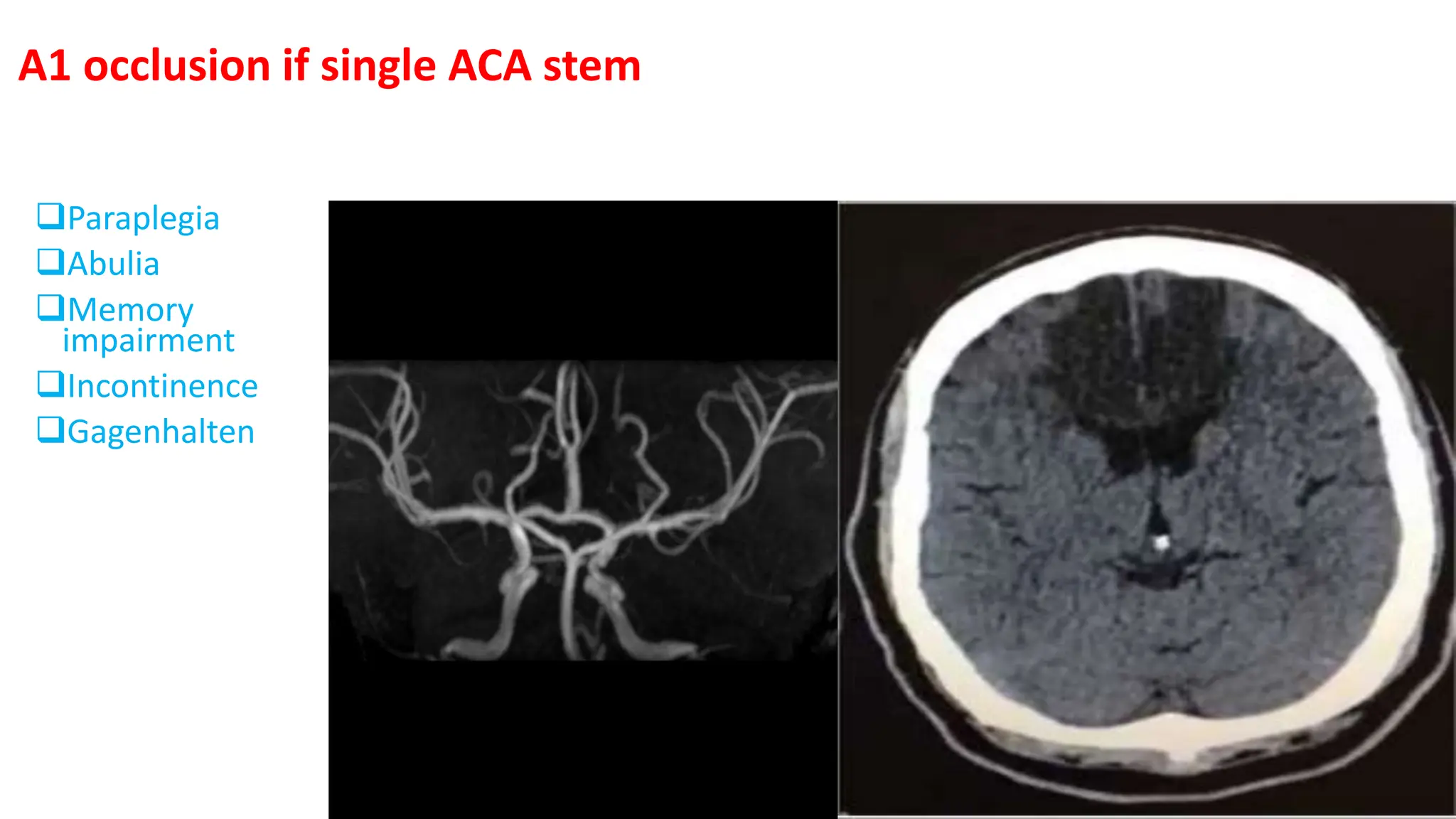 vascular supply of brain and spinal cord - Copy.pptx