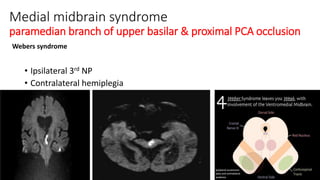 vascular supply of brain and spinal cord - Copy.pptx