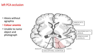 vascular supply of brain and spinal cord - Copy.pptx