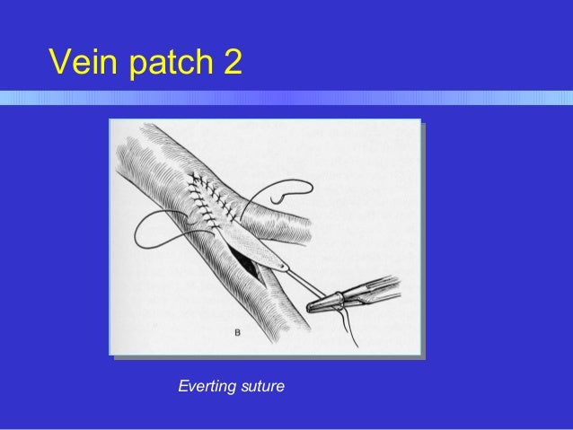 Vascular techniques Vascular techniques