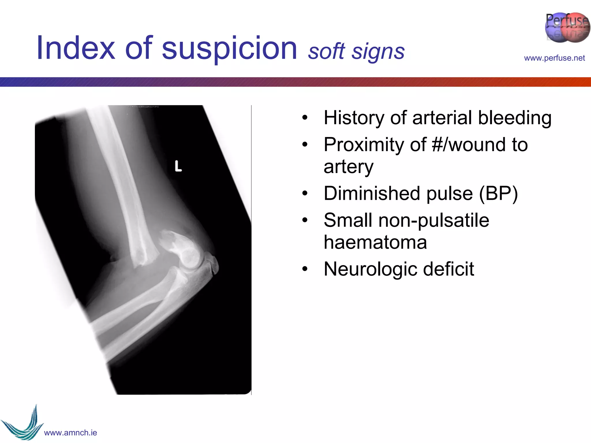 Vascular trauma | PPT