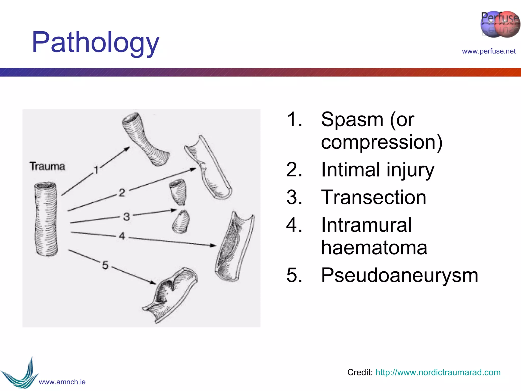 Vascular trauma | PPT