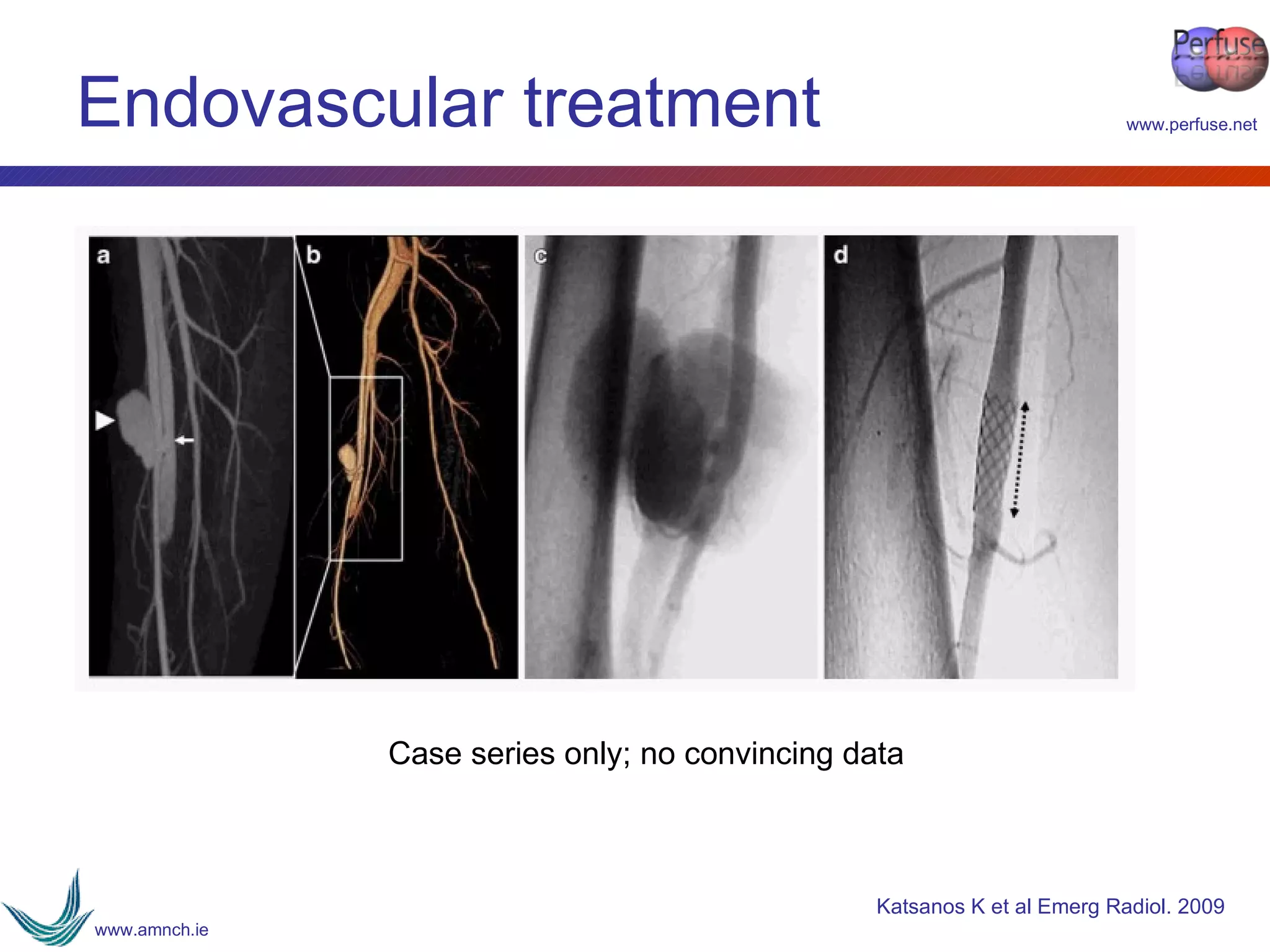 Vascular trauma | PPT