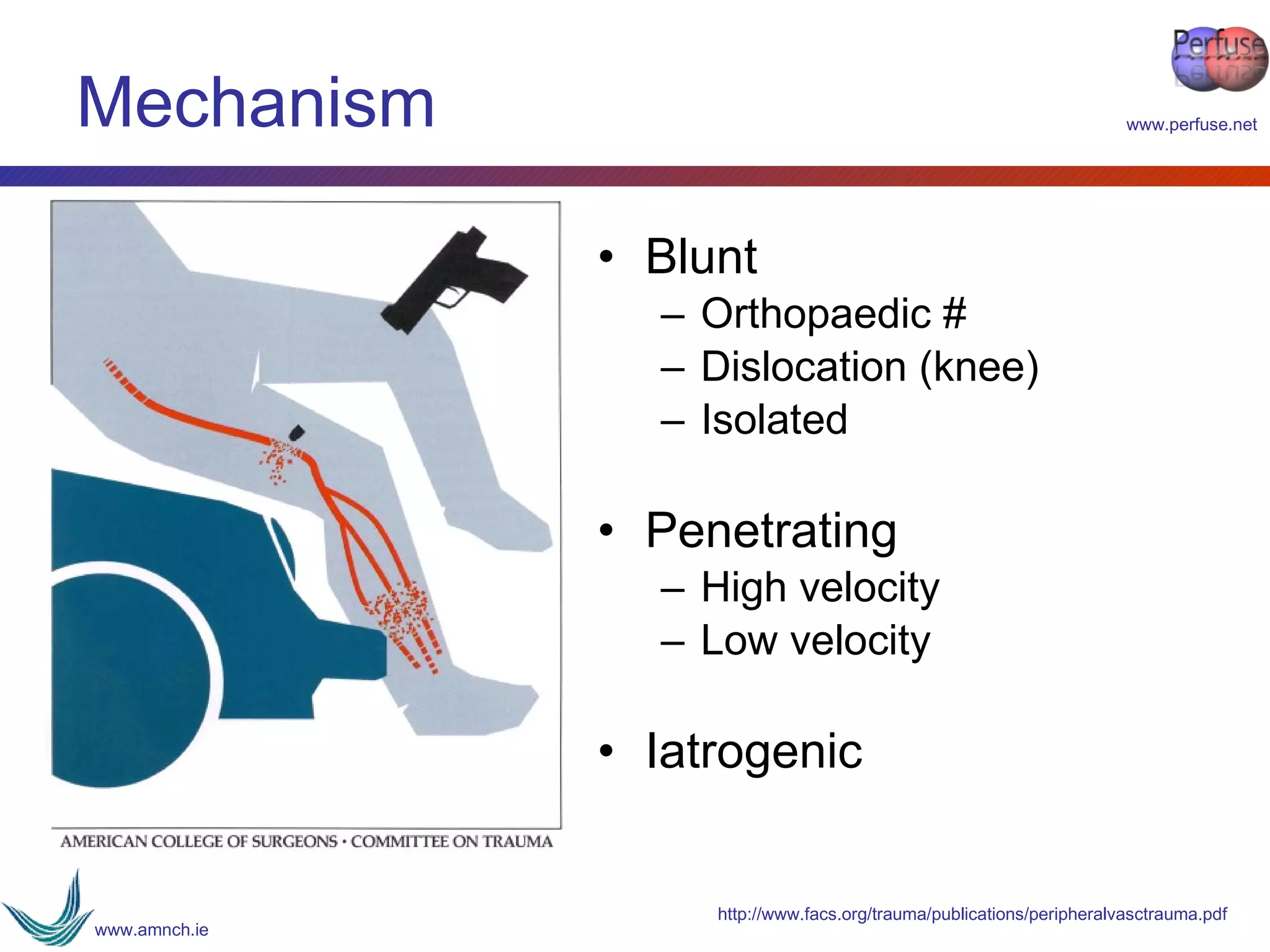 Vascular trauma | PPT