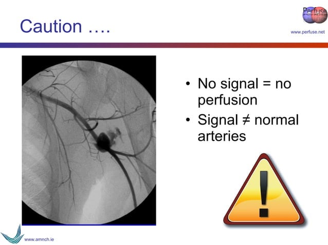 Vascular trauma | PPT | First Aid | Injuries