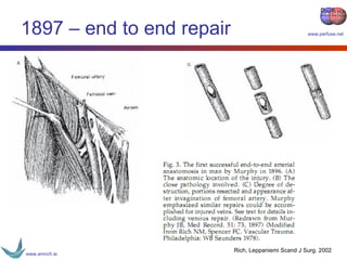 Vascular trauma | PPT
