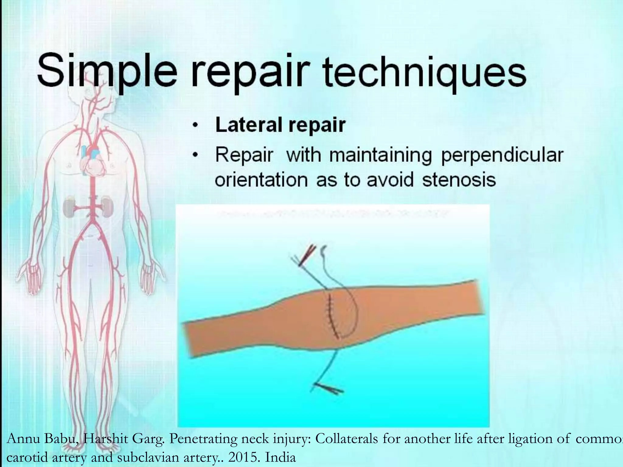 Vascular Trauma.pptx