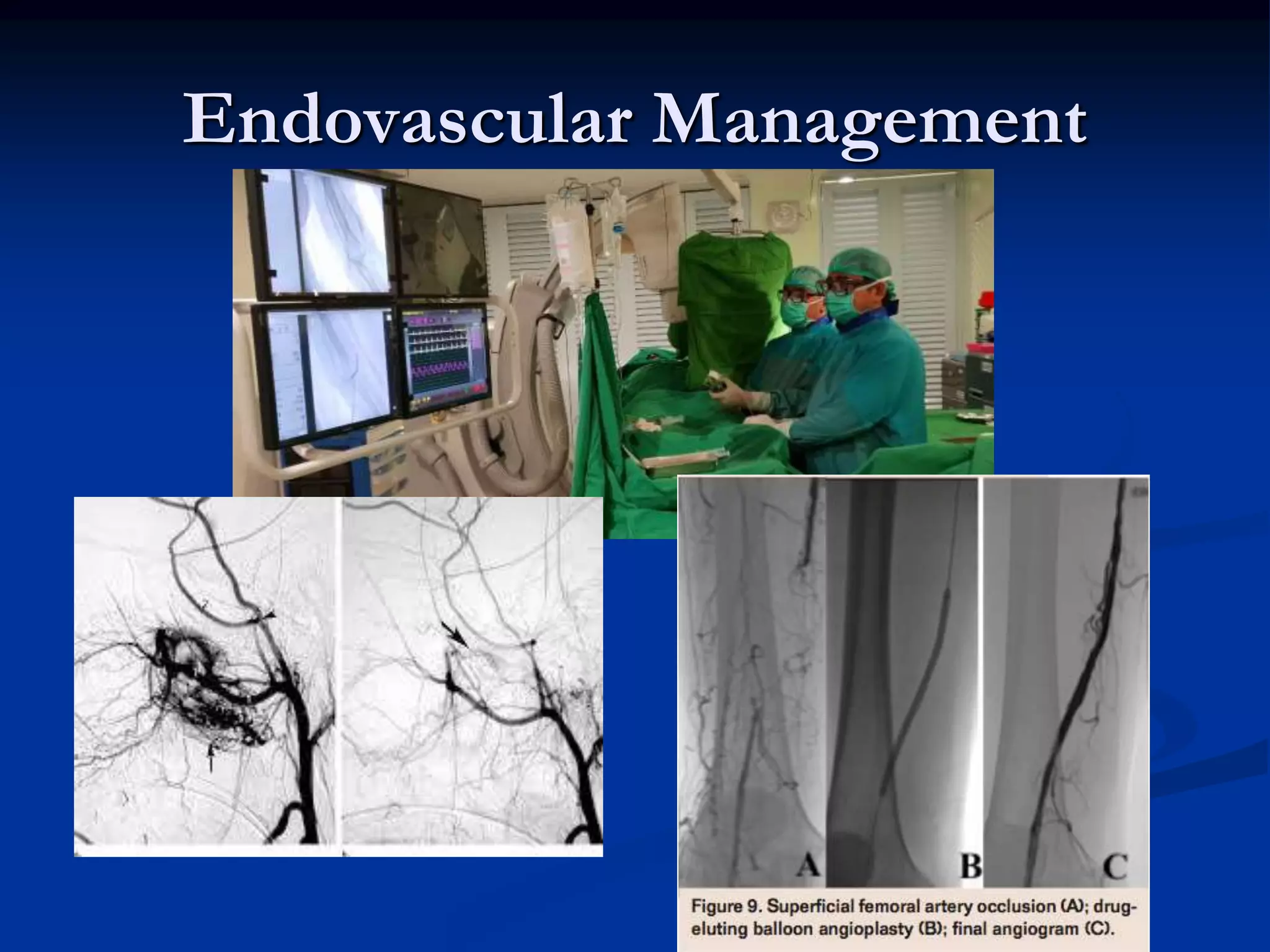 Vascular Trauma.pptx