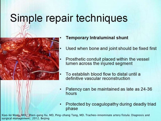 Vascular Trauma.pptx