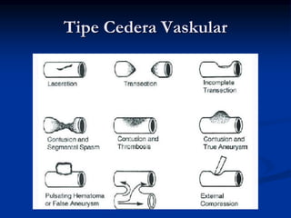 Vascular Trauma.pptx