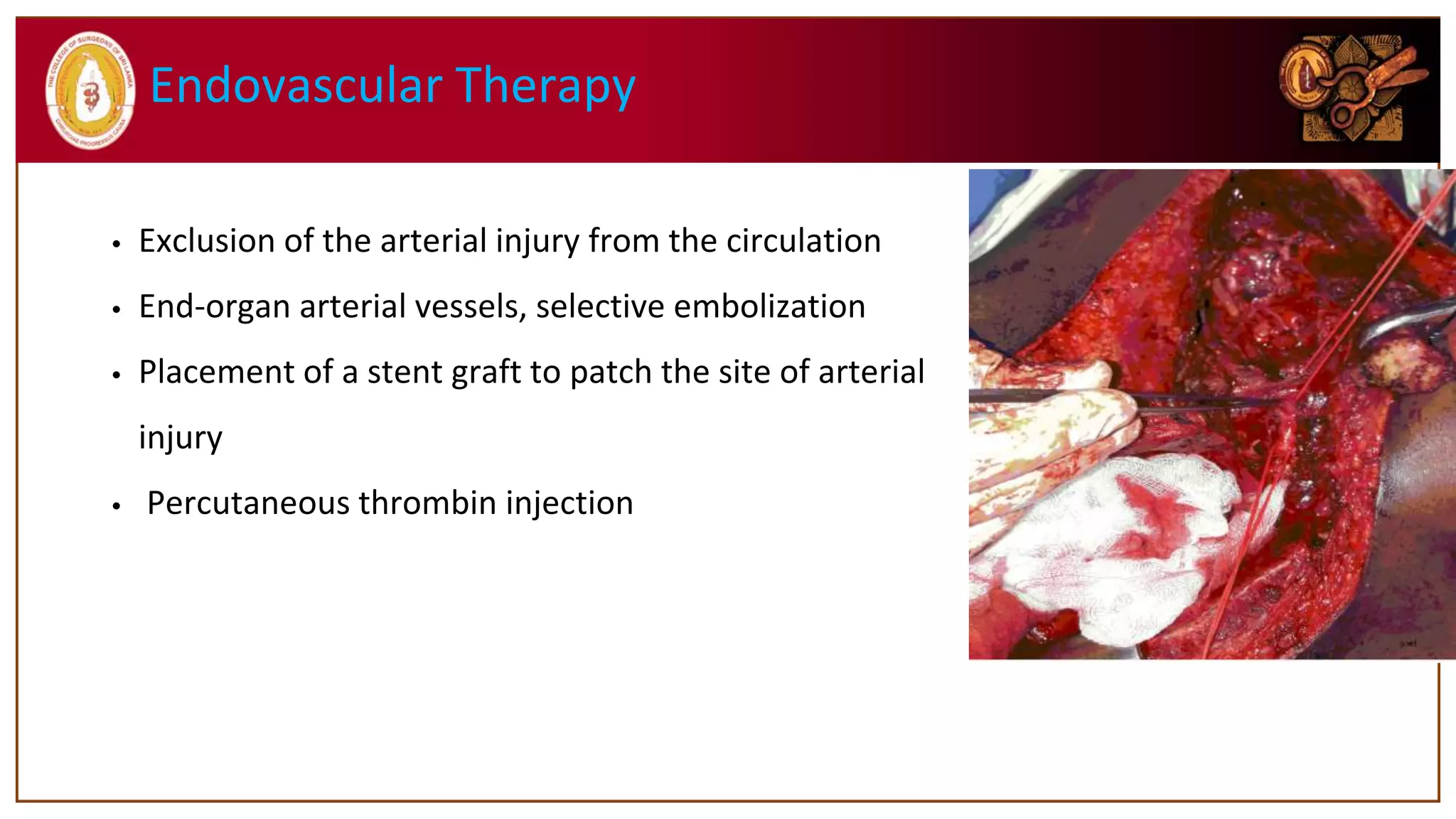 VASCULAR TRAUMA CSSL 2021 .pptx