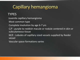 Vascular tumors of soft tissue | PPTX
