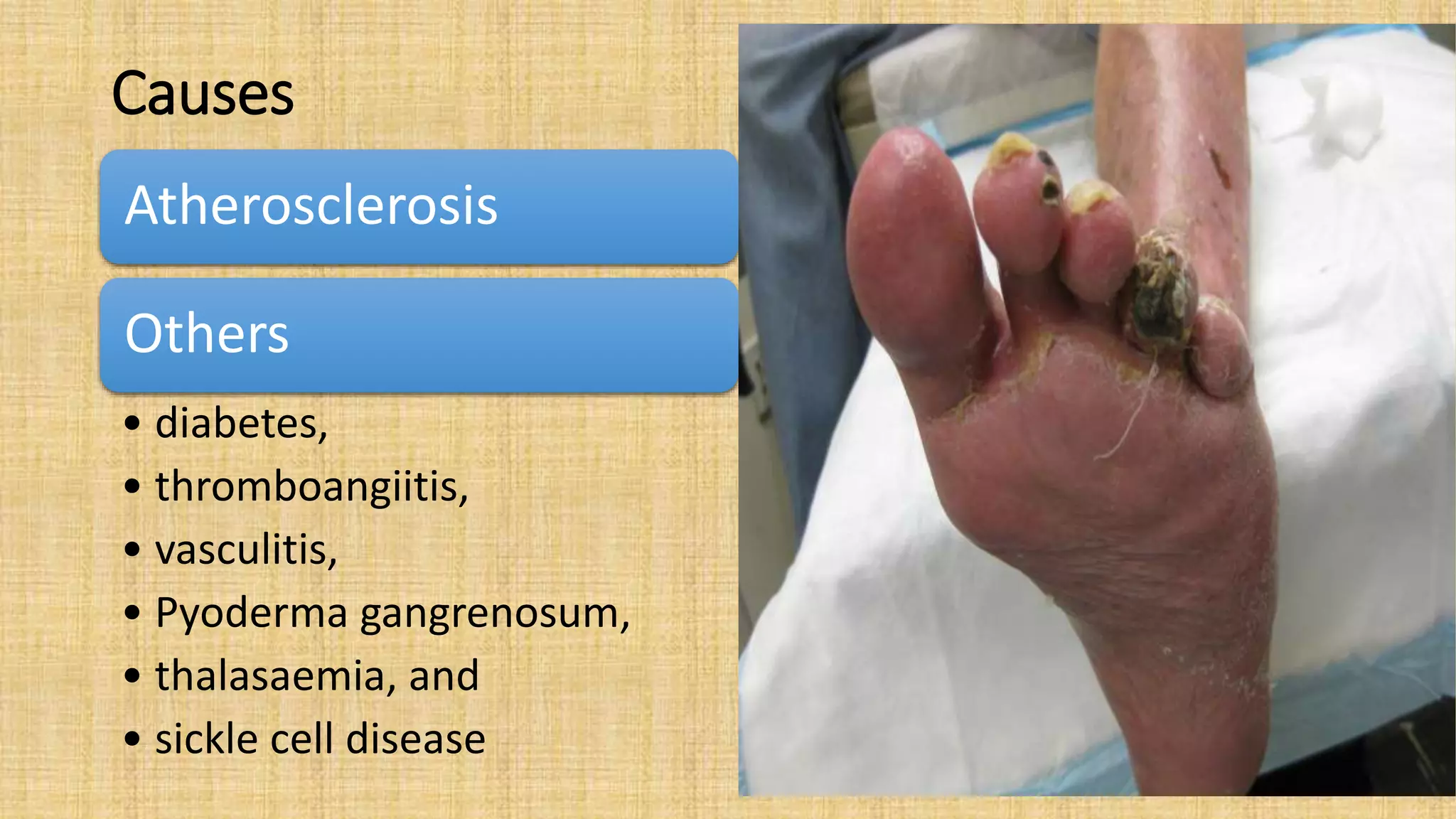Vascular ulcer.pptx