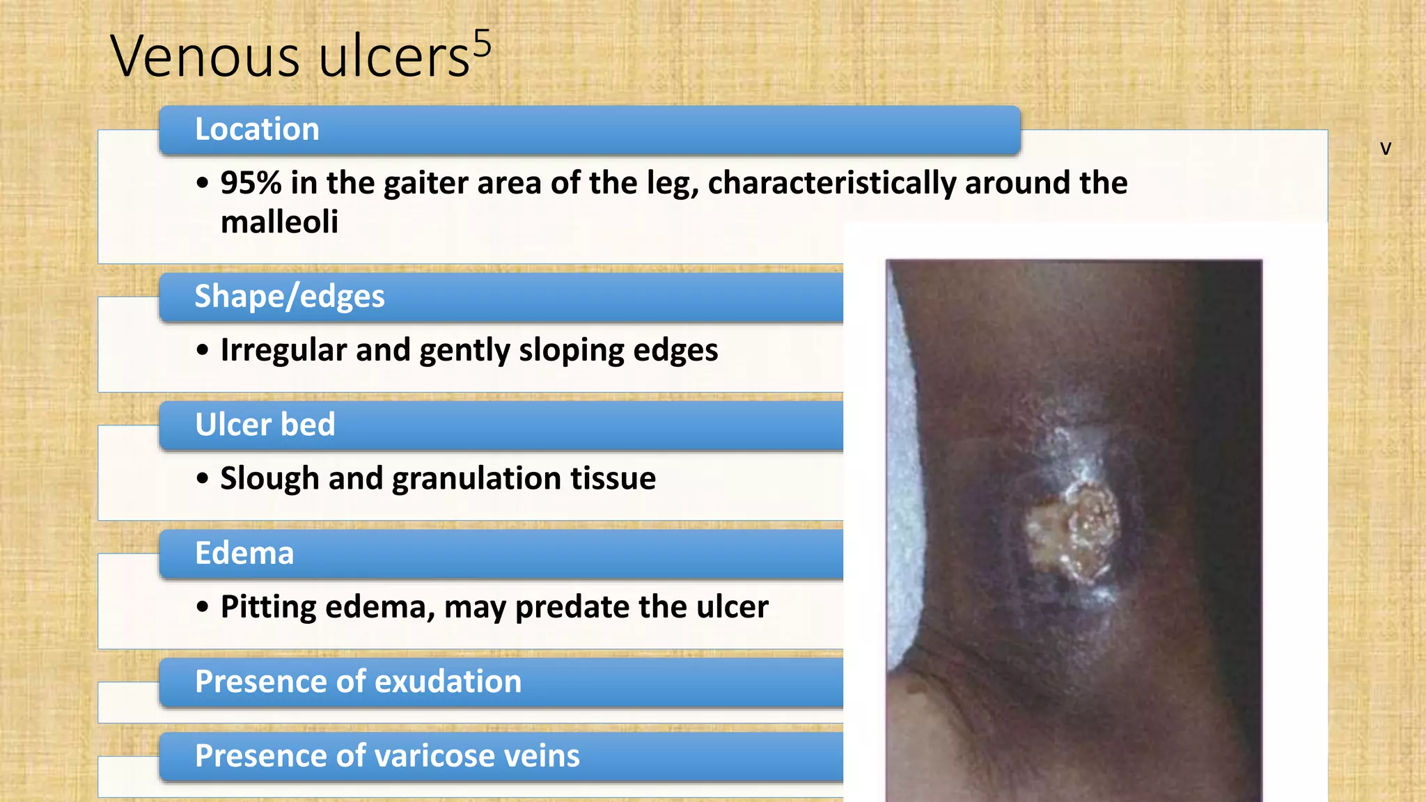 Vascular ulcer.pptx