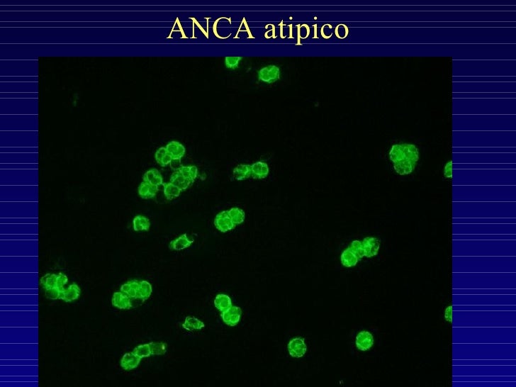 Vasculiti Primitive 2008