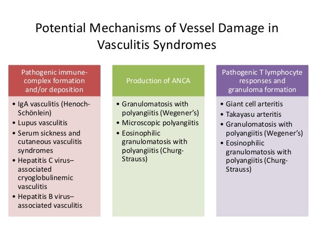 Vasculitis
