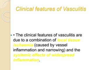 Vasculitis | PPTX