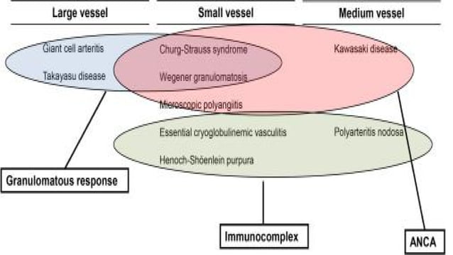 Vasculitis | PDF