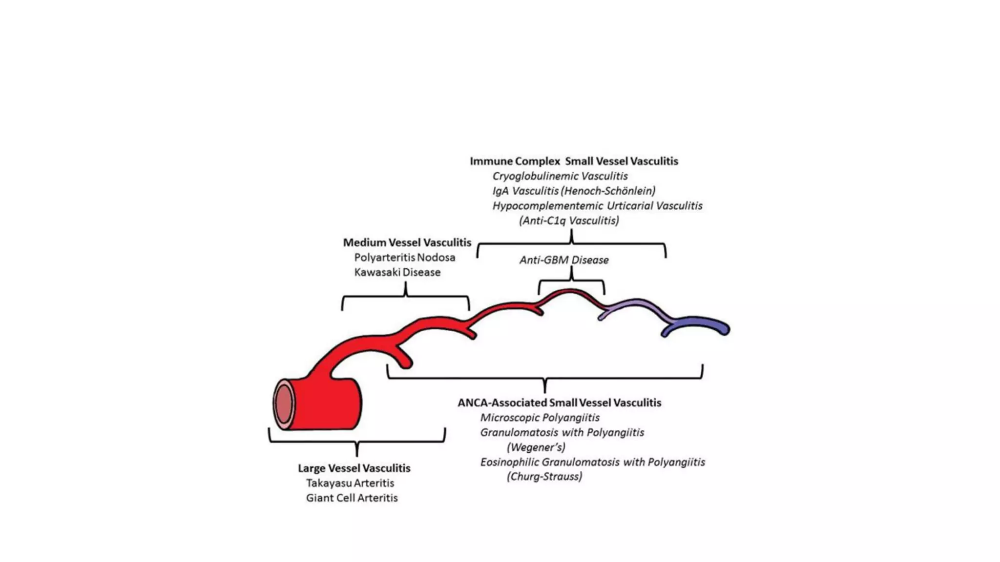 Vasculitis Revision Notes Ppt