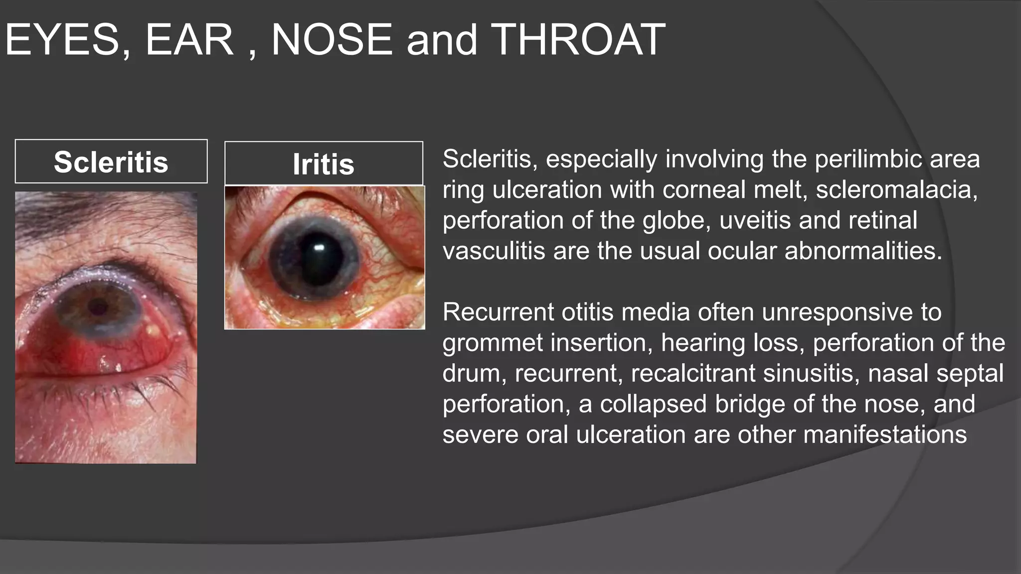 THE VASCULITIS SYNDROME | PPTX