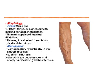 Vasculitis and varicose veins | PDF