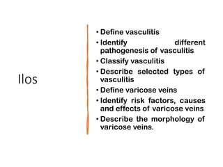 Vasculitis and varicose veins | PDF