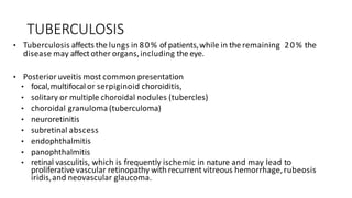 Retinal Vasculitis | PPTX