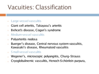 VASCULITIS.pdf