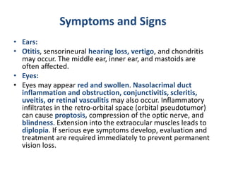 Vasculitis.pptx