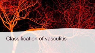 Vasculitis.pptx