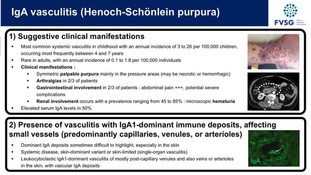 Vasculitis.pptx