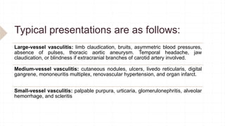 Vasculitis.pptx