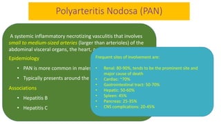 Vasculitis.pptx