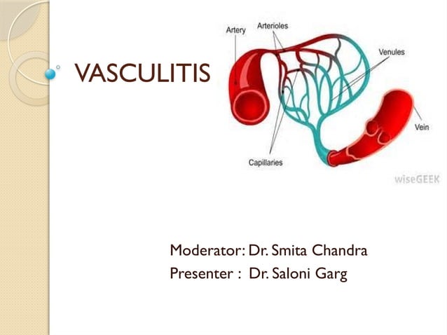 VASCULITIS.pptx different types of vasculitis | PPT