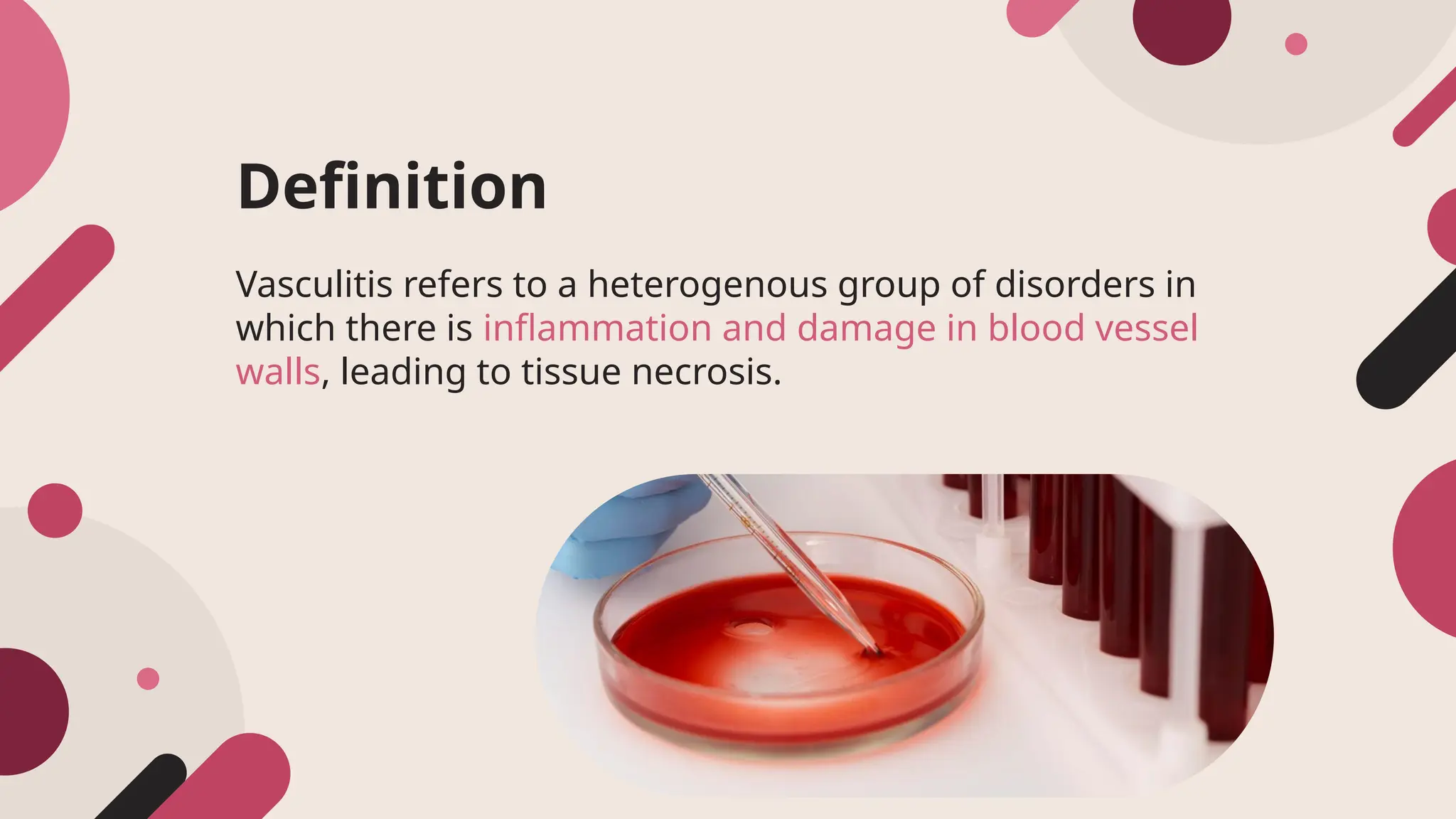 Vasculitis Definition and Classification | PPTX