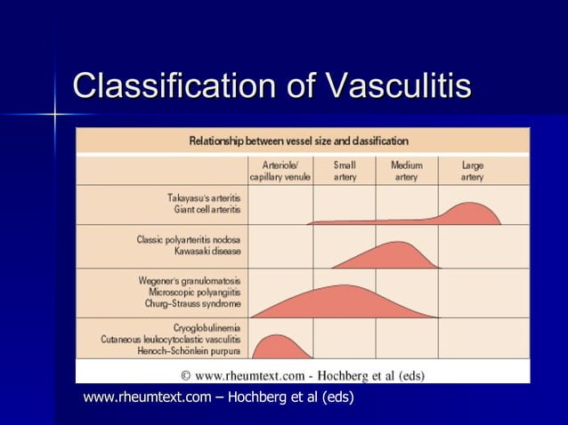 Vasculitis Overview | PPT