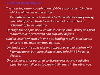 meidicine.Vasculitis 1.(dr.kawa) | PPT