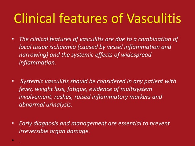 meidicine.Vasculitis 1.(dr.kawa) | PPT