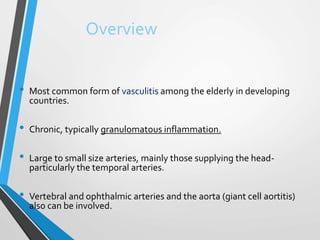 Vasculitis | PPTX