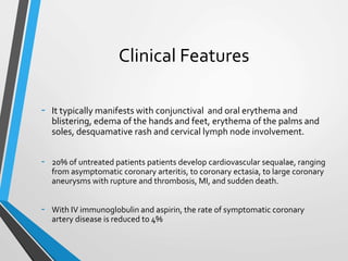 Vasculitis | PPTX