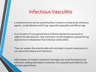Vasculitis | PPTX