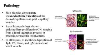Childhood Vasculitis pathology & Pathogenesis | PPTX