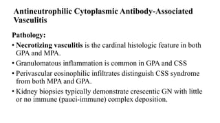Childhood Vasculitis pathology & Pathogenesis | PPTX