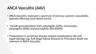 VASCULITIS Audit.pptx