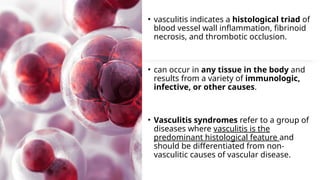 vasculitis classification in clinical medicine.pptx