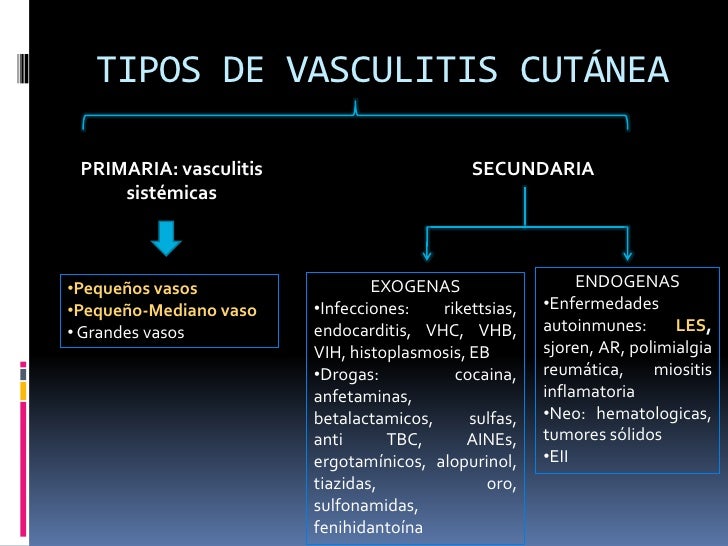 Vasculitis cutanea