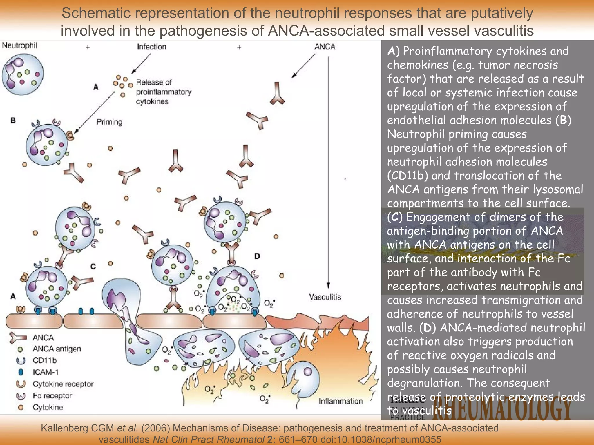 Vasculitis Wegener/Churg S | PPT