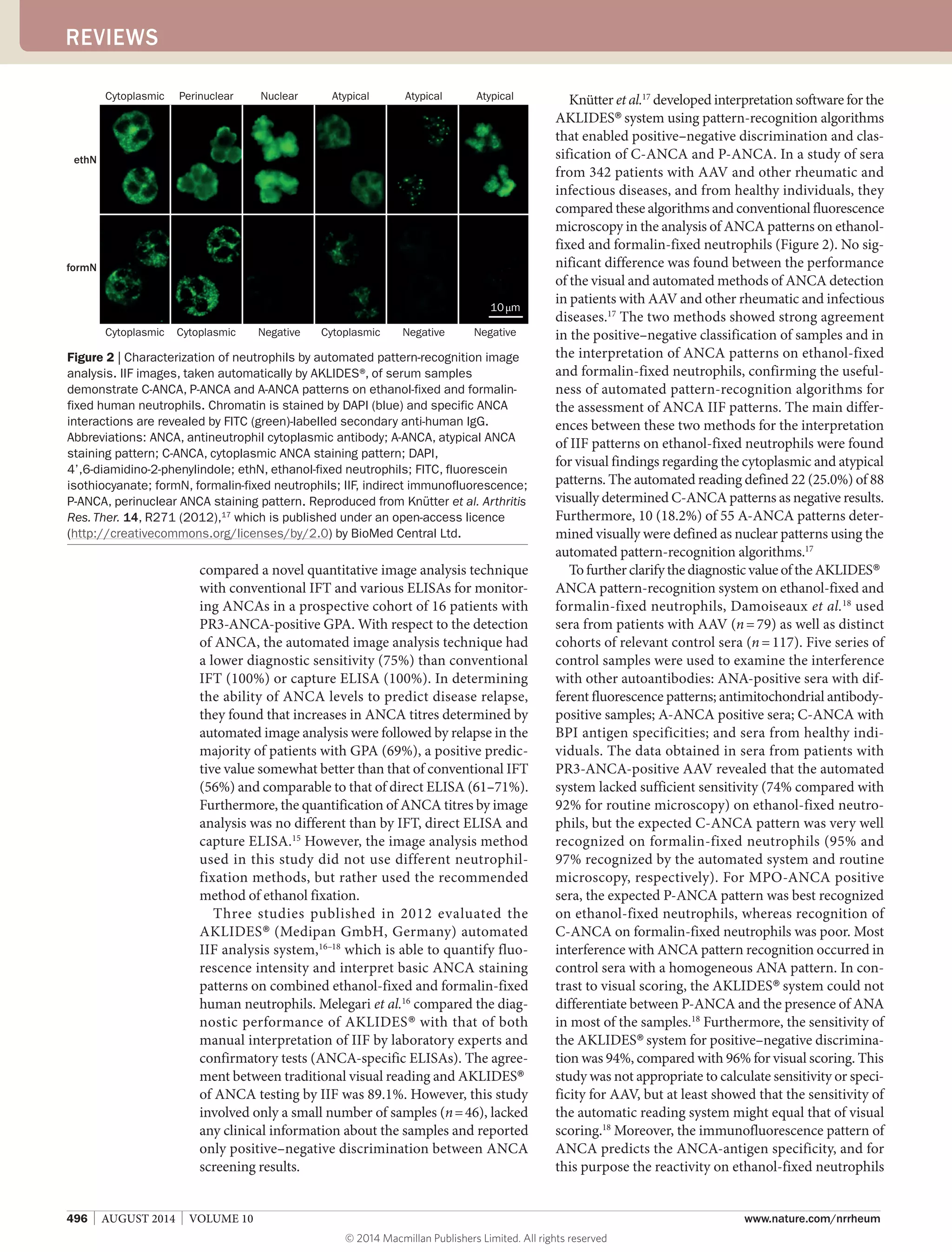Vasculitis nrrheum.2014.78