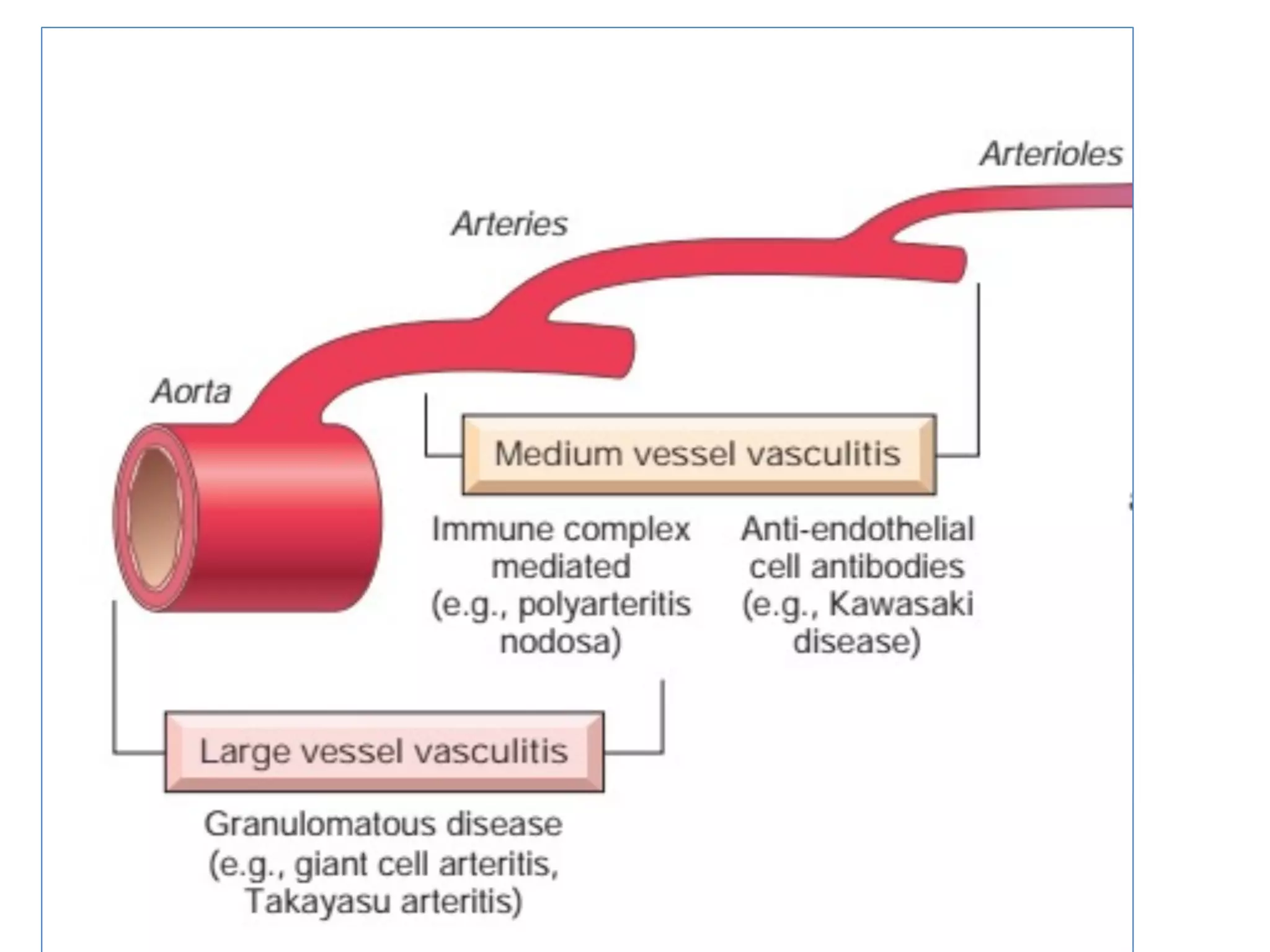Vasculitis pathology | PDF
