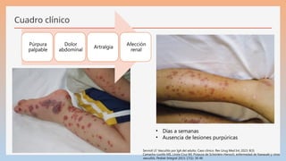 Vasculitis por IgA Purpura de Henoch Schonlein.pptx